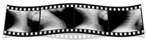 Konica Minolta Healthcare Advances Xray Imaging Dynamic Digital ...